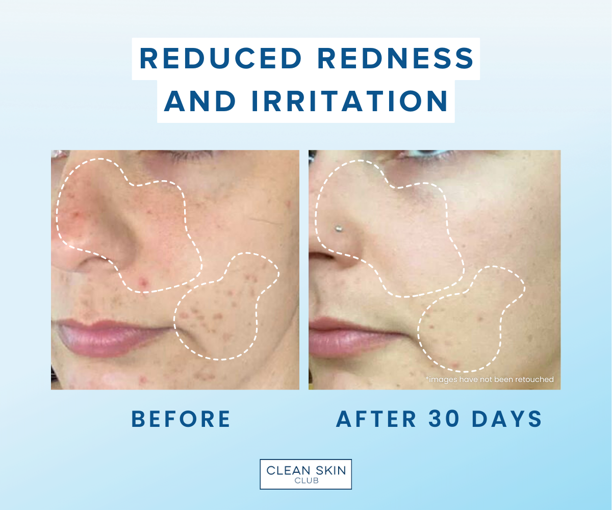 Clean Towels XL – Clean Skin Club UK